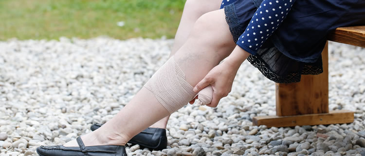 Como Prevenir Flebite (Tromboflebite) – Dr. Faz Saúde